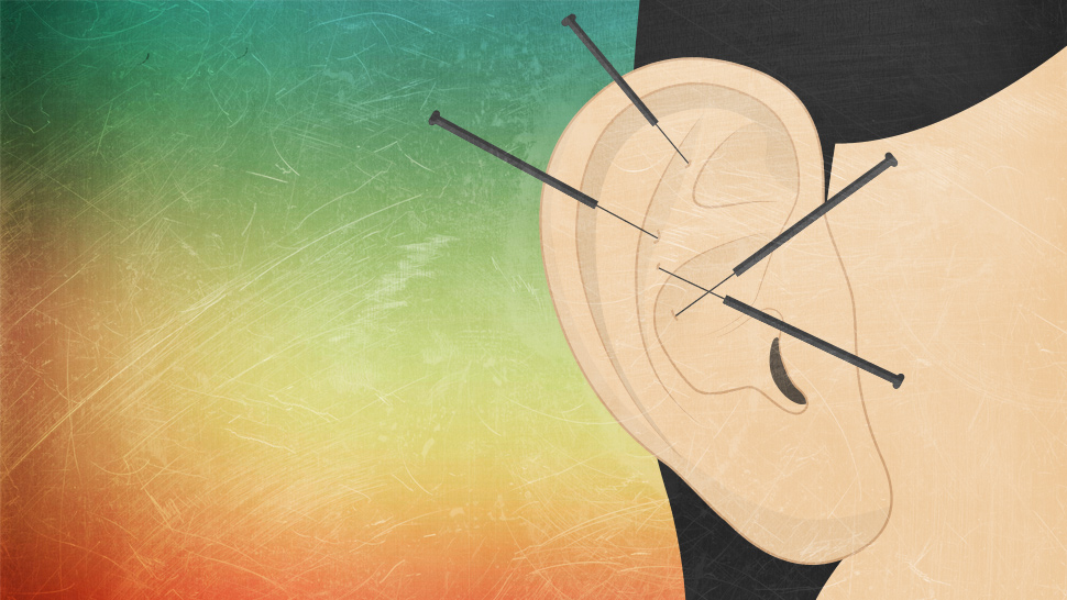 Throw An Acudetox Party For The Ultimate Relaxation